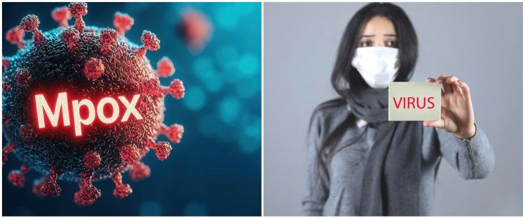 Cegah penyebaran virus Mpox, ini 9 langkah yang harus dilakukan selama ...