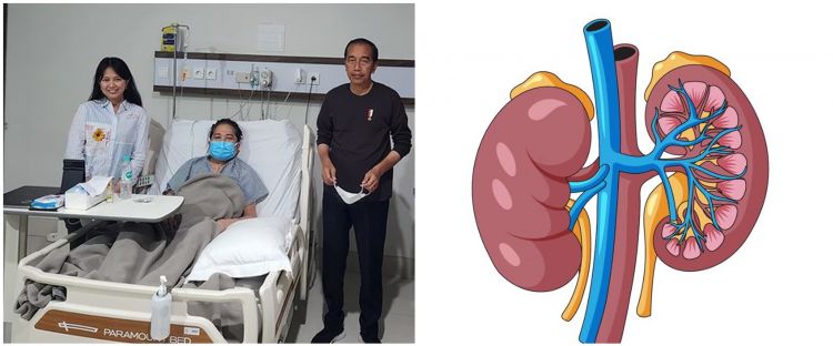 Abdee Slank idap IgA Nephropathy hingga dirawat sebulan di RS, kenali ...
