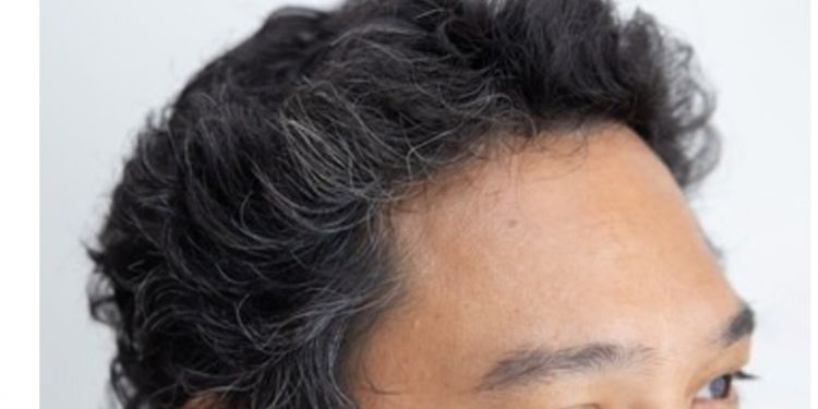 Cara kembalikan warna asli rambut yang beruban, ampuh cuma andalkan 1 ...