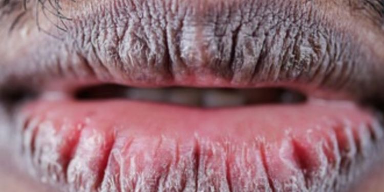 Cara bikin lip balm untuk cerahkan bibir hitam cuma pakai 1 jenis bunga ...