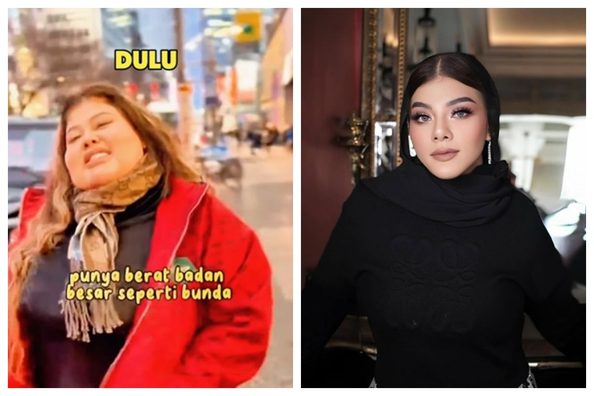 9 Portraits of Shindy Samuel's face before and after plastic surgery ...