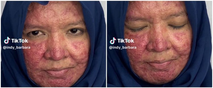Wajah bopeng gegara gonta-ganti skincare, MUA ini ubah muka pengantin ...