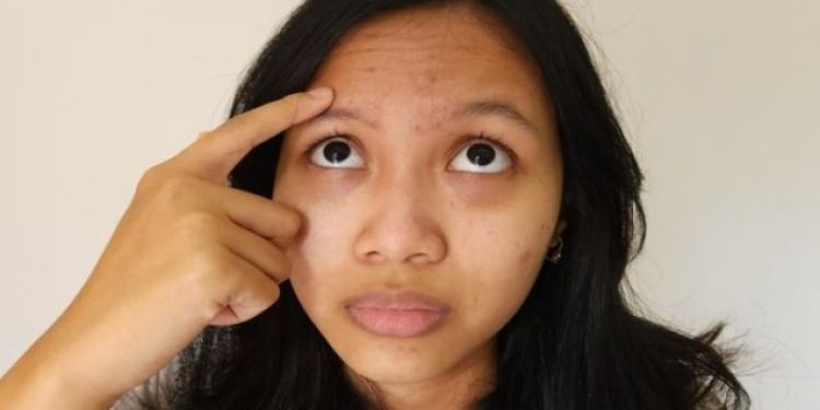 Cara cerahkan kulit kusam dan moda pigmentasi pakai 1 jenis bunga ...