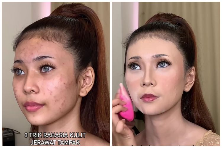 Transformasi cewek berjerawat dimakeup bold ini tampak halus bak tanpa ...