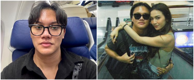 Ikuti jejak Mahalini operasi hidung, 5 penampilan terbaru Rizky Febian ...
