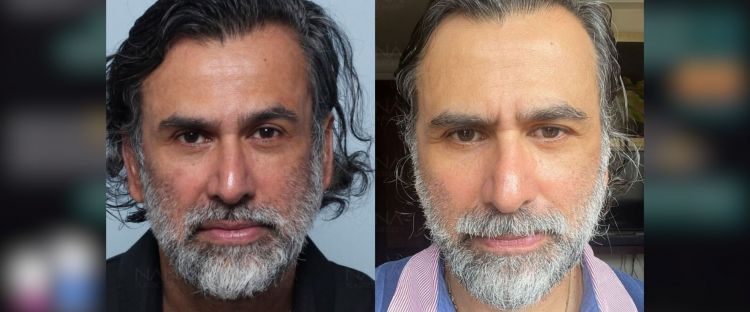 Bukan untuk awet muda tapi jaga penampilan di usia 50-an, 7 potret ...