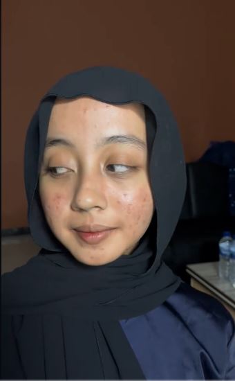 The makeup transformation of a woman with a breakout face is flawless ...