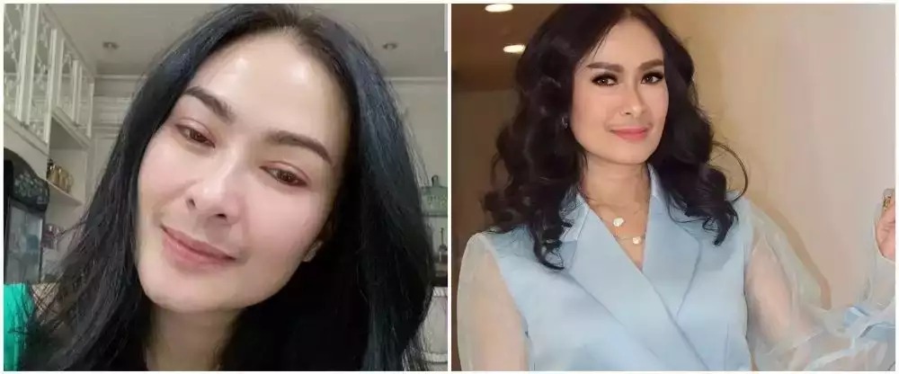 Faces become firmer and don't age, these portraits of 21 celebrities before and after Botox ...