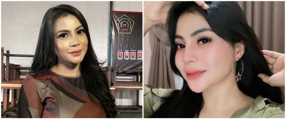 Faces become firmer and don't age, these portraits of 21 celebrities before and after Botox ...