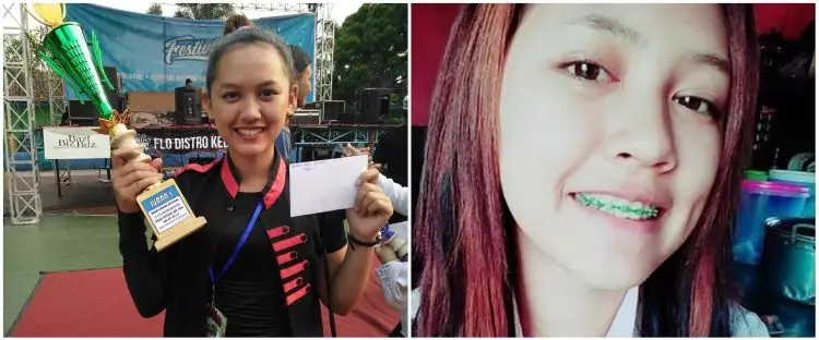 6 Potret Happy Asmara sebelum dan sesudah perawatan gigi, penampilannya ...