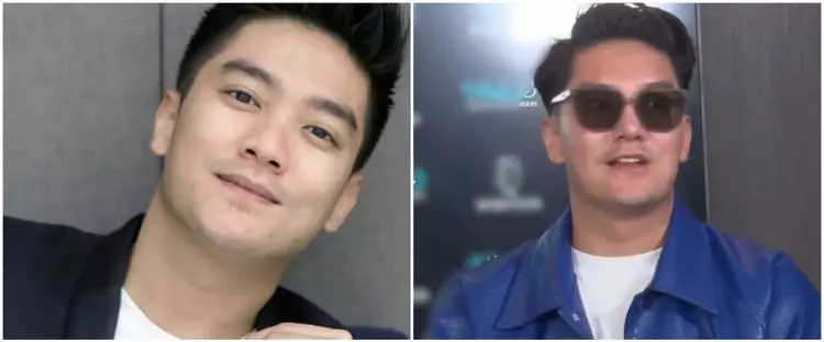 Diam-diam Boy William ubah bentuk hidung, begini potretnya sebelum dan ...