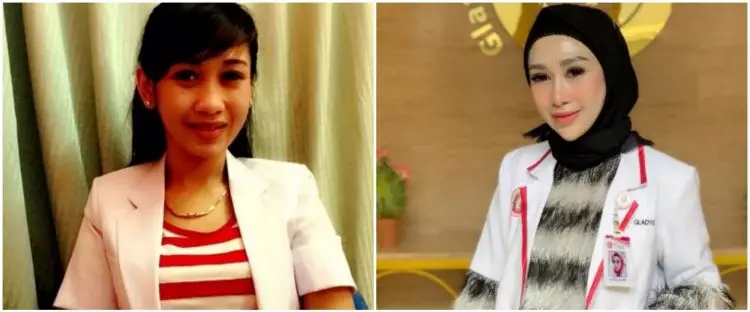 Kakak ipar Siti Badriah ini ternyata jadi bos skincare, begini 7 potret dulu dan kini Reza Gladys