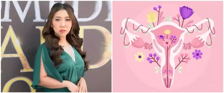 Kenali gejala kista ovarium & penyebabnya, penyakit yang diderita Kiky Saputri sampai alami ...