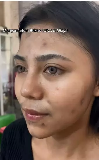 Kekuatan makeup bikin wajah wanita penuh flek hitam ini jadi dewy