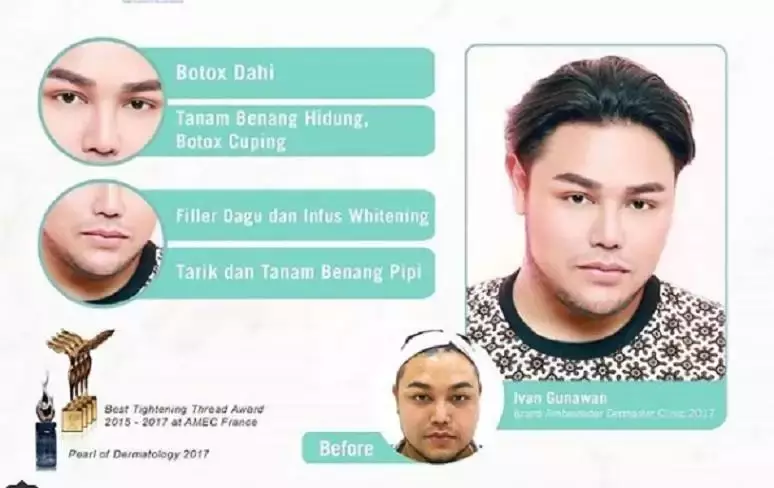 Faces become firmer and don't age, these portraits of 21 celebrities ...