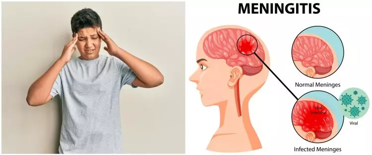 Dapat sebabkan kerusakan otak, kenali bahaya meningitis: gejala ...
