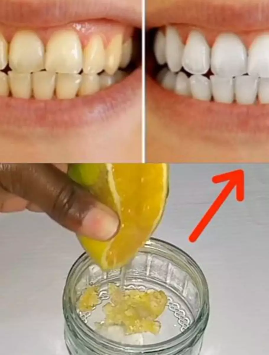 There is no need to buy whitening paste, this trick to overcome yellow crusted teeth only uses 2 ...
