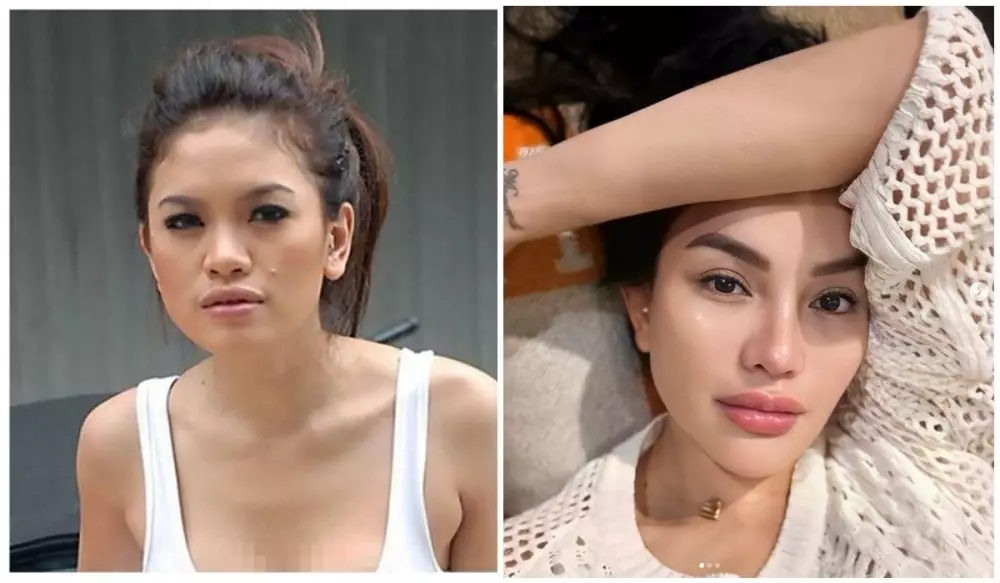 Spend IDR 1 billion for facial makeover, here are 9 photos before & after Nikita Mirzani's ...