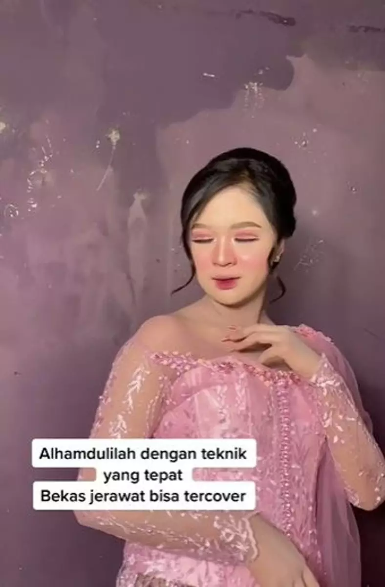 Breakout face on the day of the proposal, the girl was given MUA pinky ...