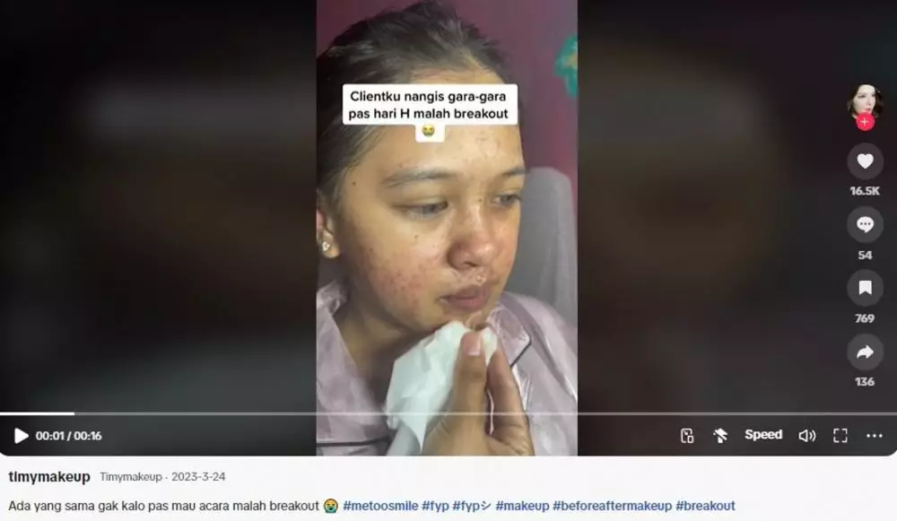 Breakout face on the day of the proposal, the girl was given MUA pinky ...