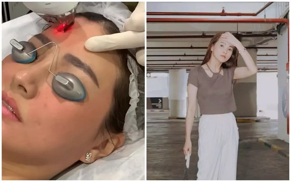 9 Portraits of Sarwendah before and after facial makeover, spend IDR 300 million to get rid of ...